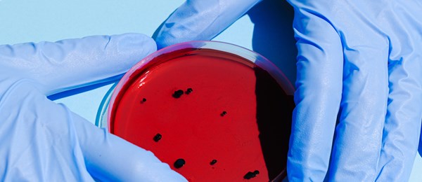 What are germs and how do they spread? | Dettol